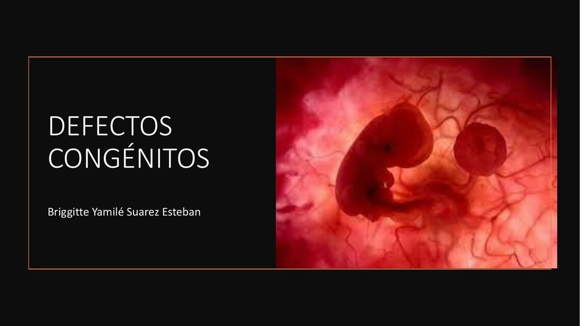 Defectos congénitos | Briggitte Yamilé Suarez Esteban | uDocz