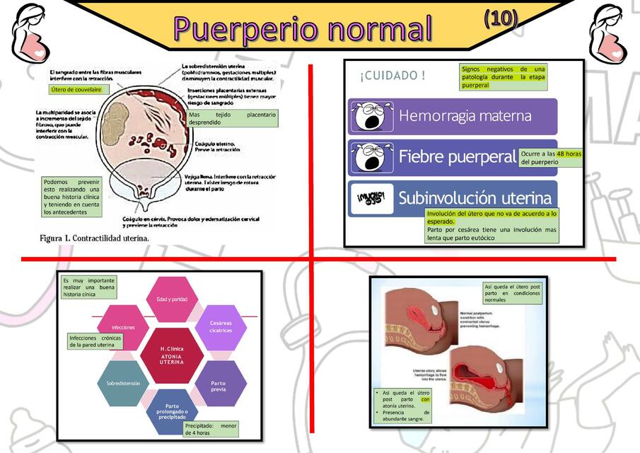 Puerperio Normal (10) | J/Diego P/Vásquez | uDocz