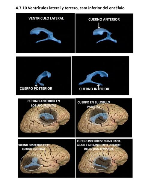 Vistas del ventrículo lateral y tercero, cara inferior del encéfalo