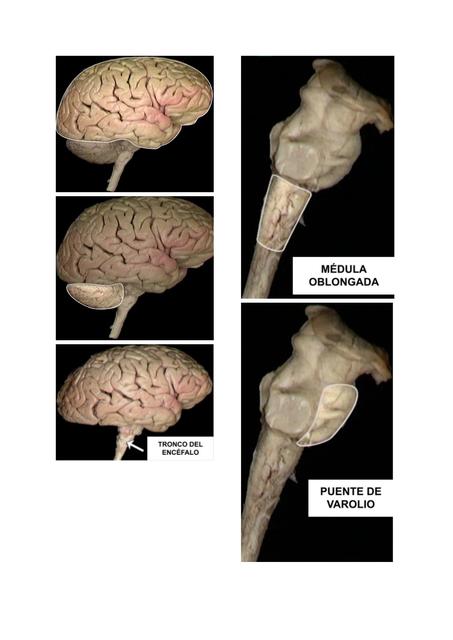 Revisión Del Tronco Encefálico Cerebro Y Cerebelo Lucy Valverde Udocz