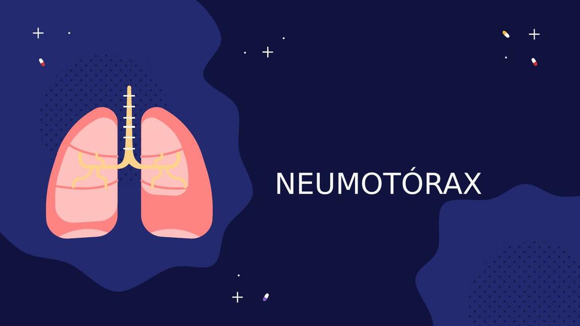 NEUMOTÓRAX | Dr. Memorize | uDocz