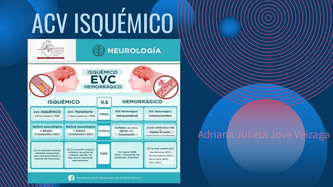 ACV Isquémico | ADRIANA JULIETA JOVÉ VEIZAGA | uDocz