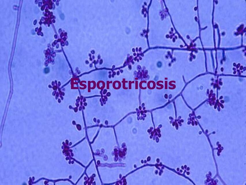 Esporotricosis- Cromomicosis | CIENCIAS DE LA SALUD | uDocz