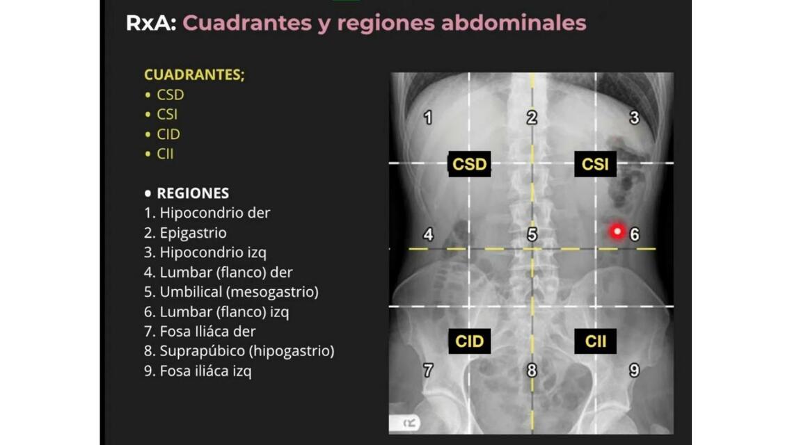Resúmenes de Cuadrantes abdominales | Descarga apuntes de Cuadrantes ...