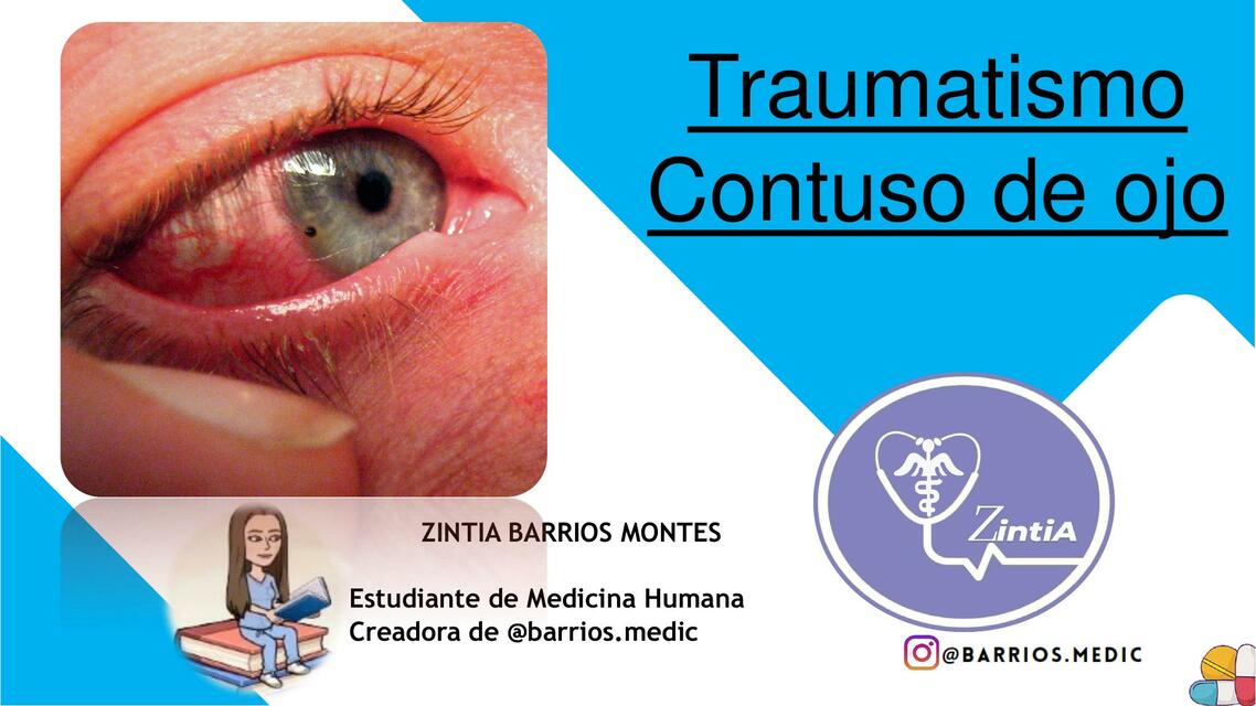 Traumatismo Ocular , Traumatismo ocular: síntomas, causas y tratamiento ...