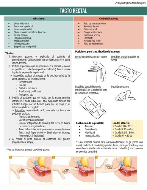 Guía tacto rectal
