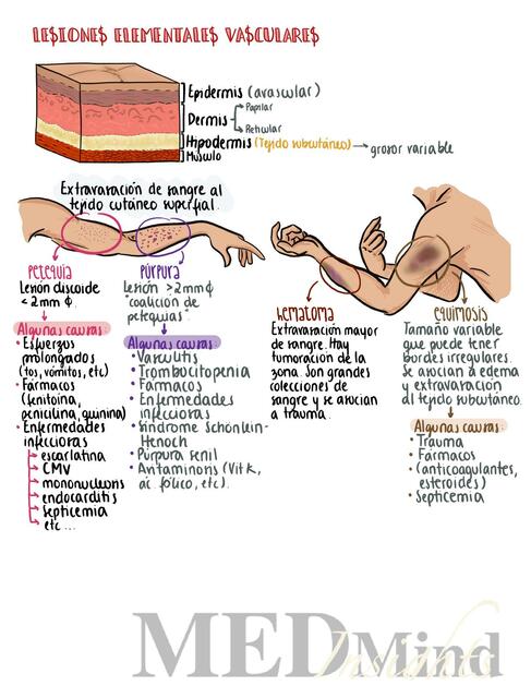 Lesiones Vasculares Elementales | Med x Rosie | uDocz