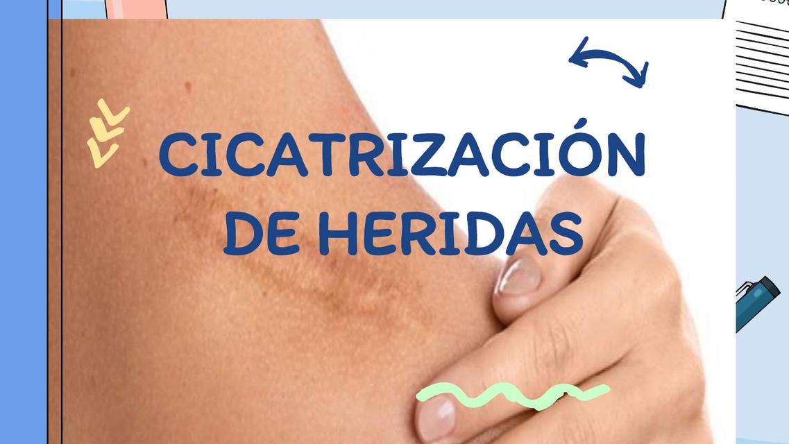 Cicatrización de heridas | medicina eli | uDocz