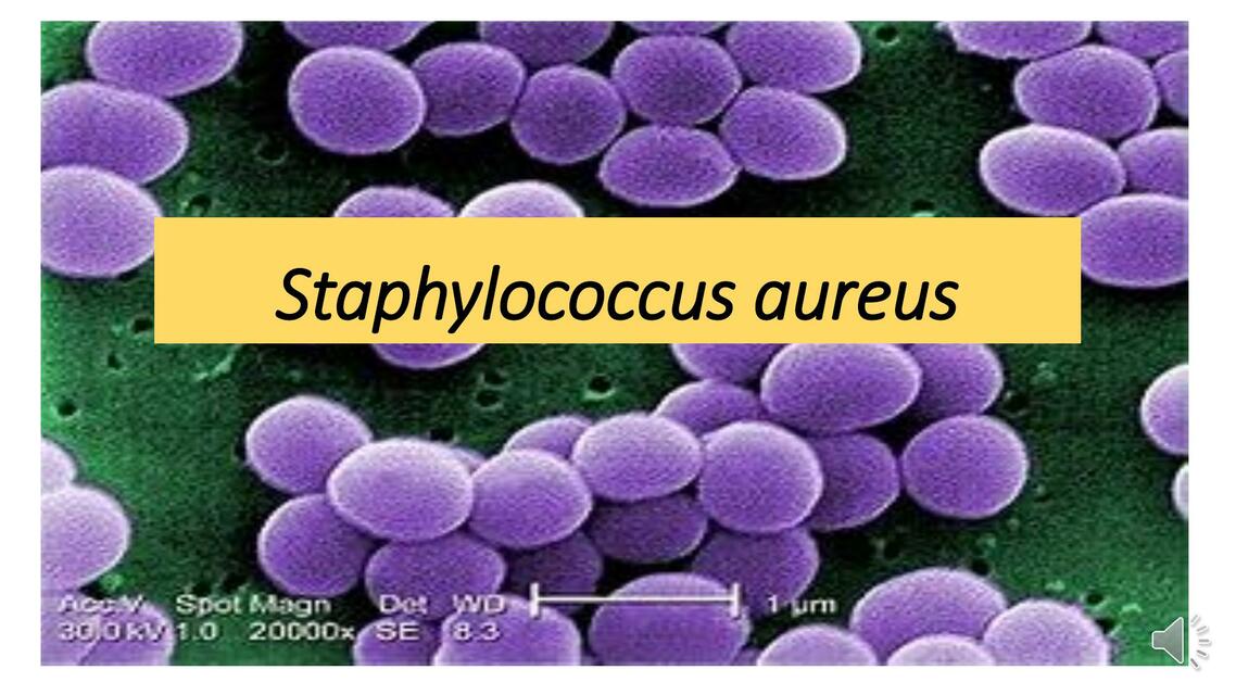 Resúmenes de Estafilococo aureus | Descarga apuntes de Estafilococo aureus