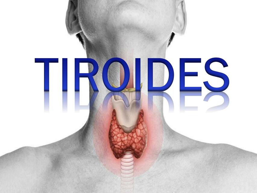 Tiroides | Escuela medica | uDocz