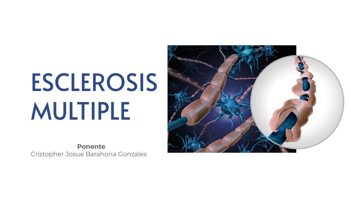 Esclerosis multiple | Dra.Brodmann | uDocz