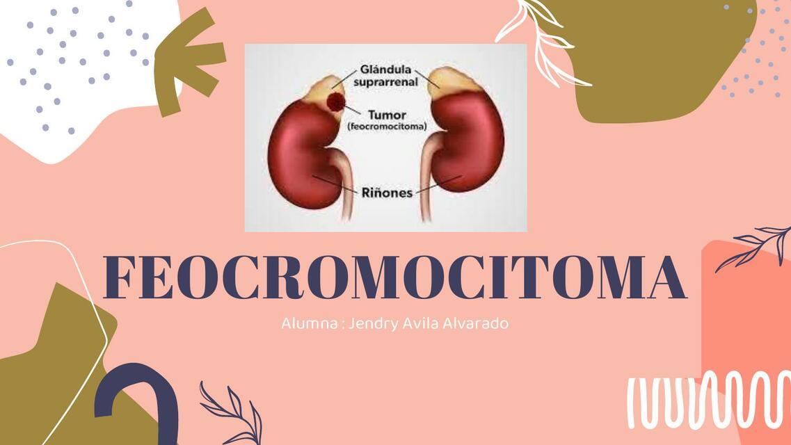 Feocromacitoma | Jendry Avila | uDocz