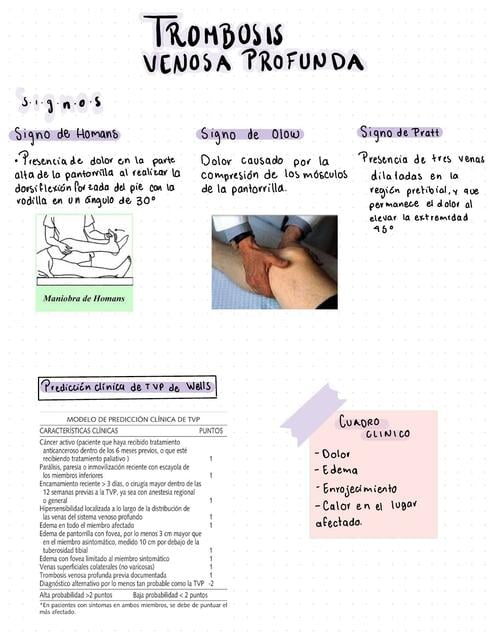 Trombosis venosa profunda | De Santiago Chairez Montse | uDocz