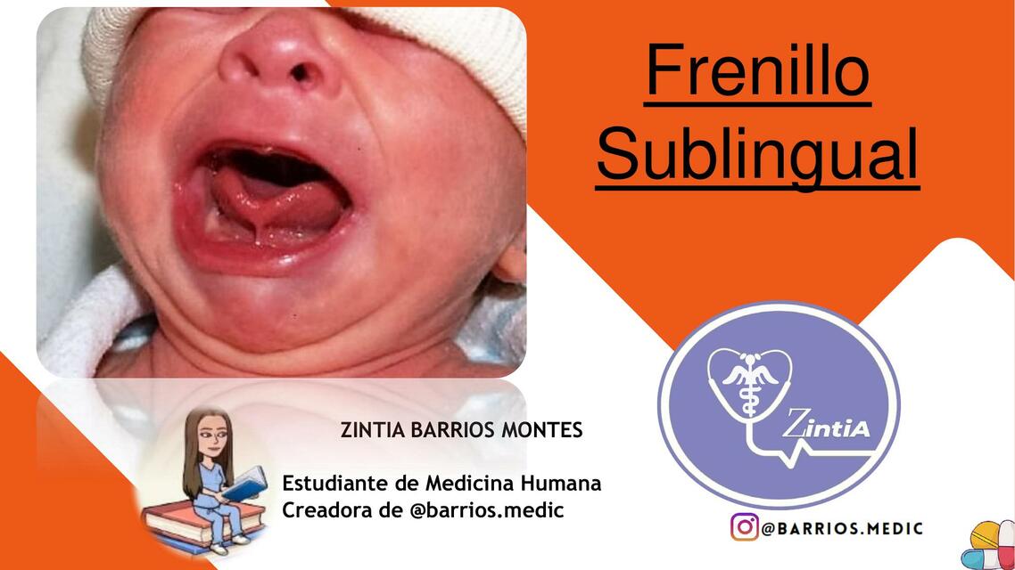 Frenillo Sublingual | BARRIOS MEDIC 👩‍⚕️📚 | uDocz