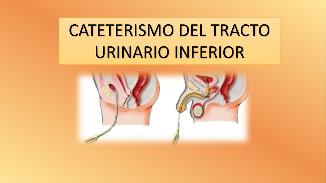 Cateterismo del tracto urinario inferior | Esther Saona | uDocz