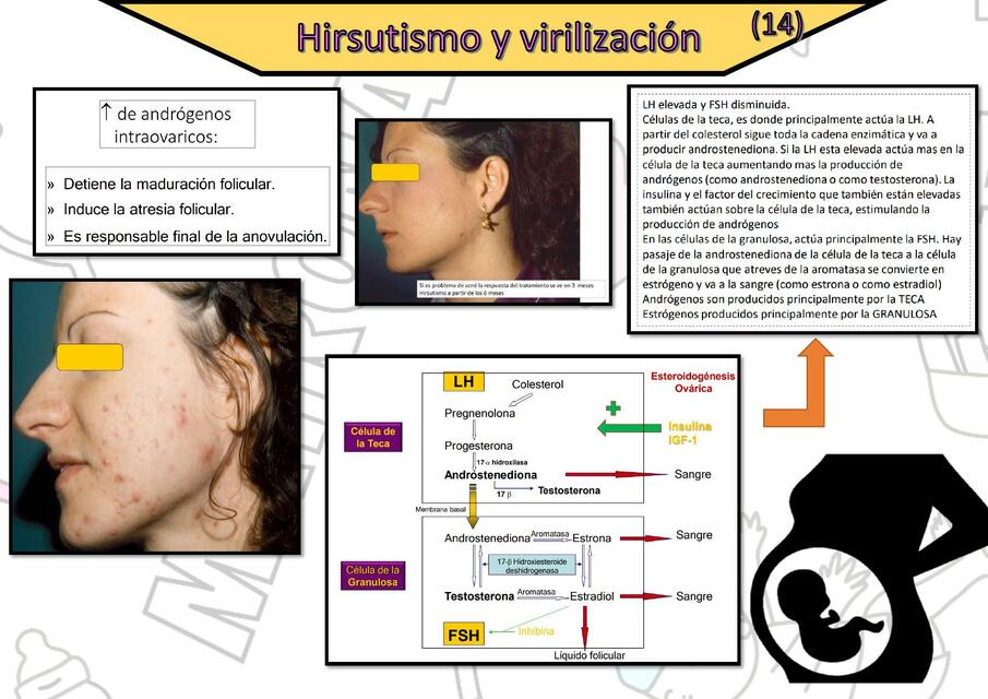 Hirsutismo y Virilización | J/Diego P/Vásquez | uDocz