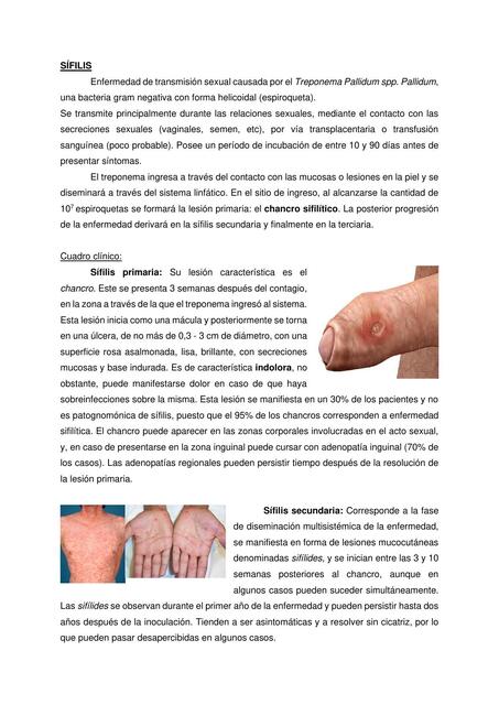 ETS | Santiago Gonzalez | uDocz