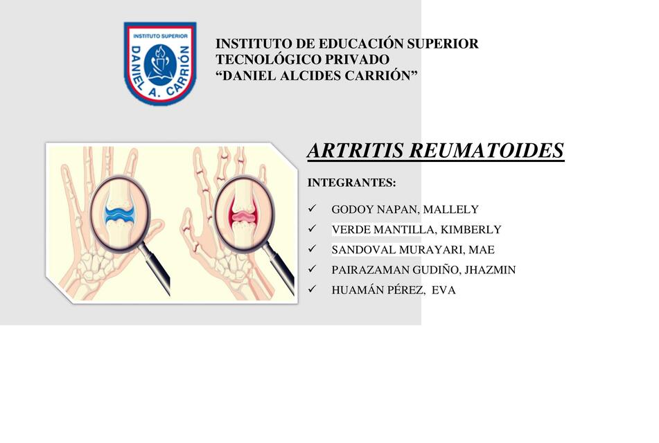 Artritis Reumatoides | Mallely Godoy Napan | uDocz