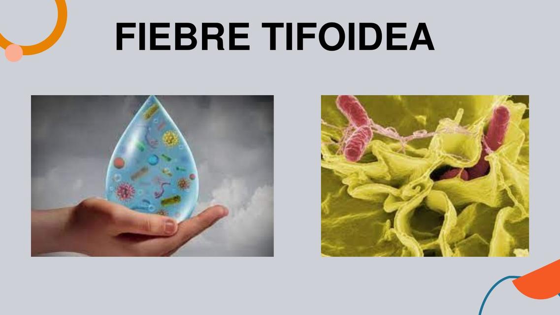 Fiebre tifoidea | Doctor_teco | uDocz