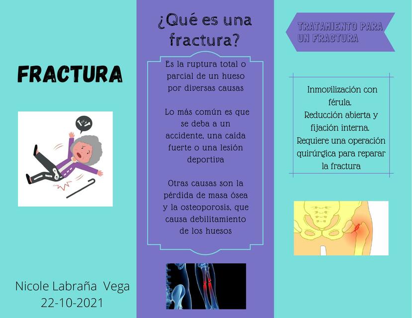 Fisiologia De Las Fracturas