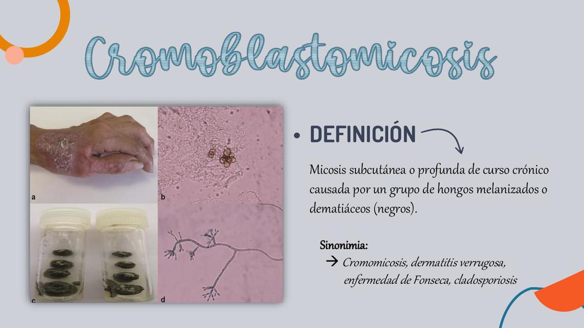 Cromoblastoicosis | Doctor_teco | uDocz
