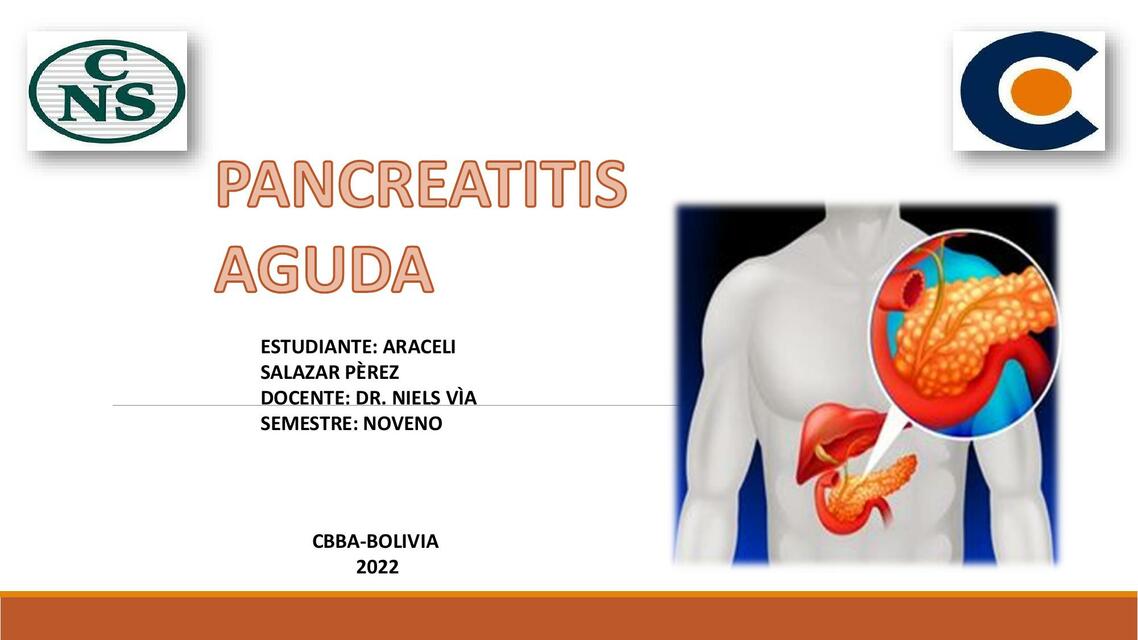 Pancreatitis Aguda | arasalazarpz | uDocz