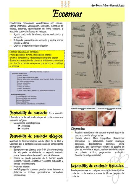Eccemas. Ana Paula Pedon | Dra. Ana Pedon | uDocz