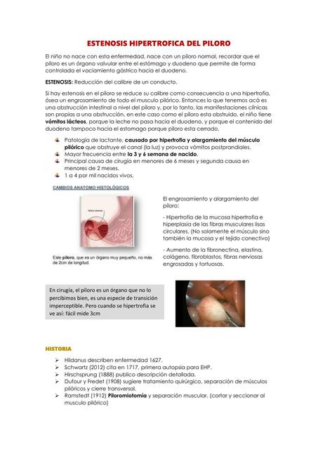 Estenosis Hipertrófica del Piloro | Sabiduría Médica | uDocz