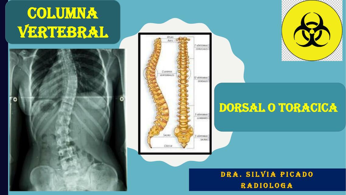 Columna Vertebral | José_28 Pérez V | uDocz