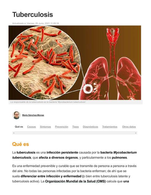 Tuberculosis- Causas, Síntomas, Prevención y Tratamiento | medicbiologia12 | uDocz