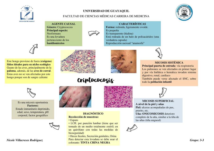 Resúmenes de Criptococosis | Descarga apuntes de Criptococosis