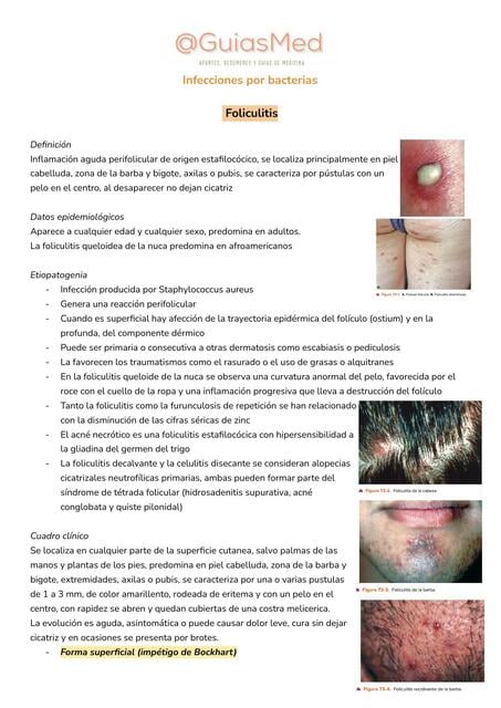 Foliculitis - Dermatología | GuiasMed | uDocz