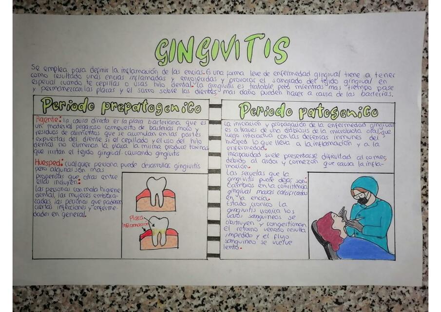 Gingivitis | Sandra Huarachi | uDocz