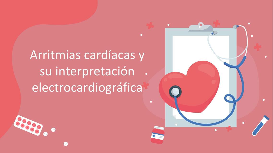 Arritmias cardíacas y su interpretación electrocardiográfica ...