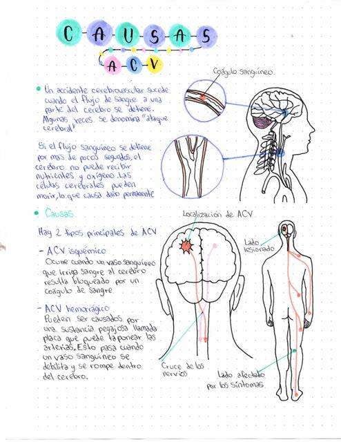 Causas ACV (accidente cerebro vascular) | MedByIsrael | uDocz