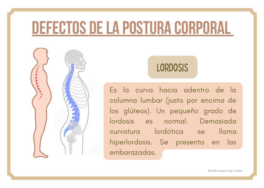 Defectos de la Postura Corporal | Anatolearning_notes (Fátima Paico B ...