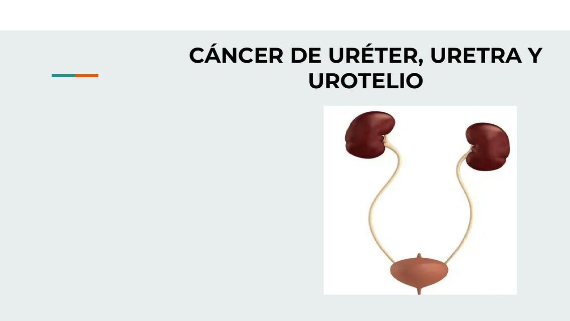 Cáncer de uréter y uretra | Erick Hernández | uDocz