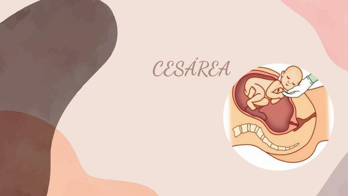 Cesárea | Erick Hernández | uDocz