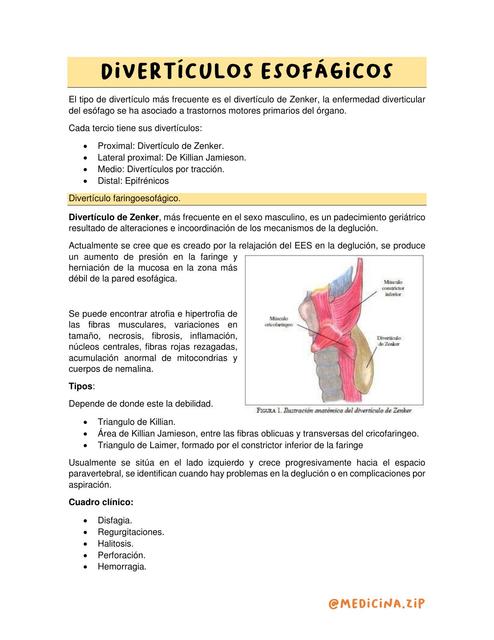 Divertículos esofágicos | Medicina.zip | uDocz