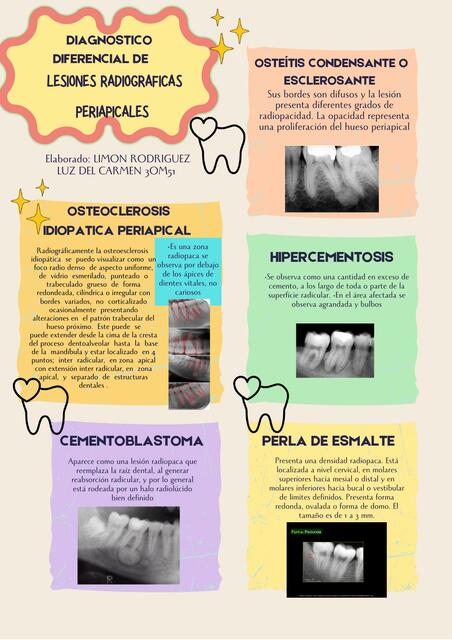 Lesiones radiopacas del periapice | Limon Rodriguez Luz del Carmen | uDocz