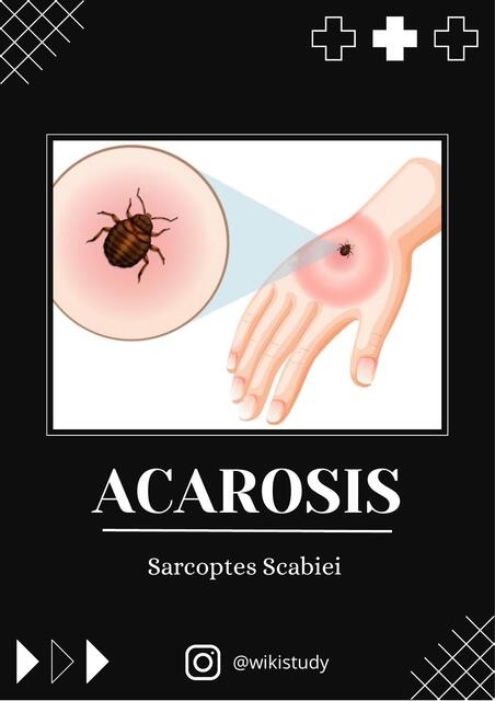 ACAROSIS | uDocz