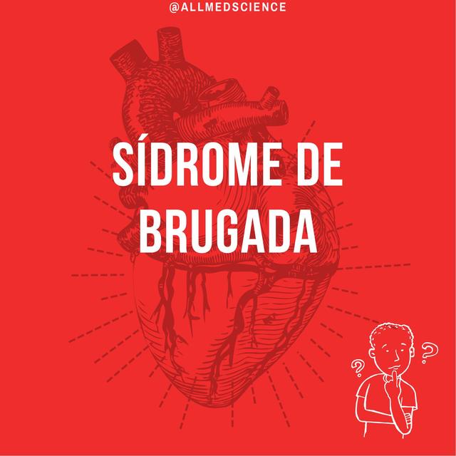 Síndrome de Brugada | RoseMedScience ( Rose Mary Favier ) | uDocz