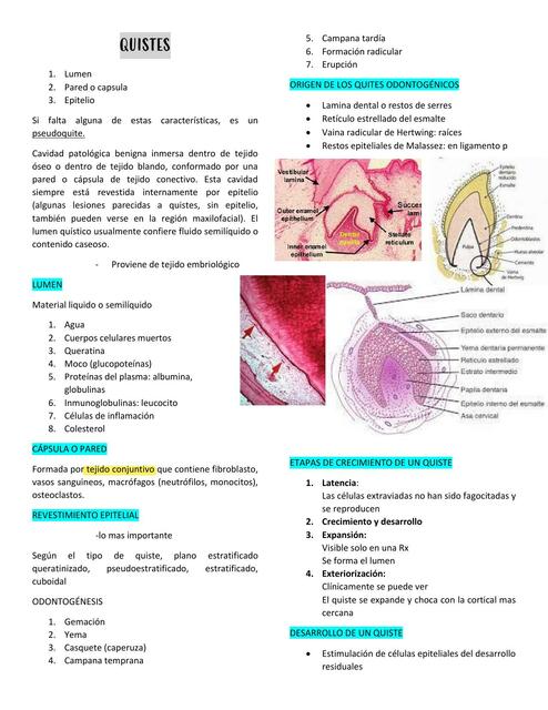 Quistes Y Neoplasias Bucales Fernanda Martinez Udocz