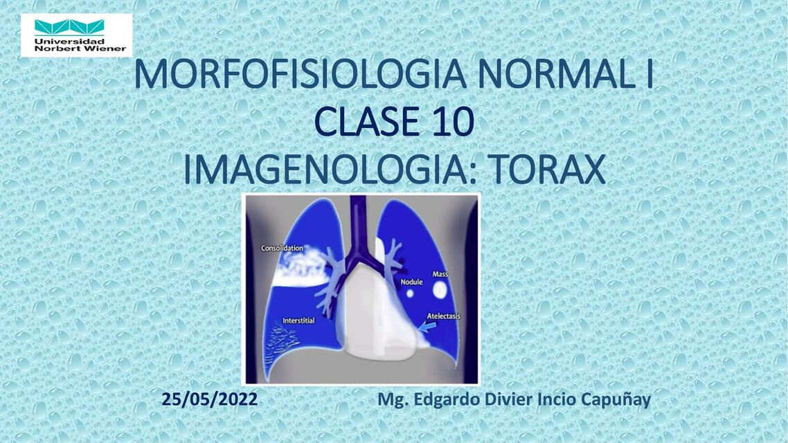 Resúmenes de Patología de tórax | Descarga apuntes de Patología de tórax