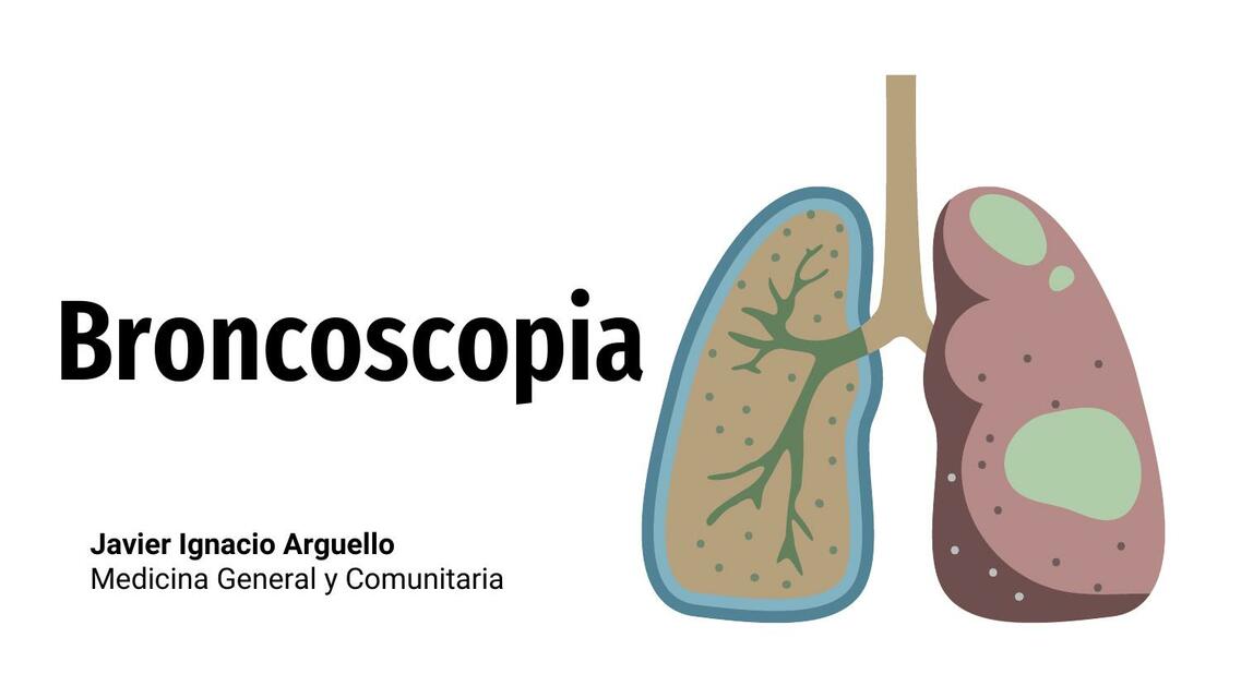 Broncoscopia | Javier Ignacio Argüello Gutierrez | uDocz