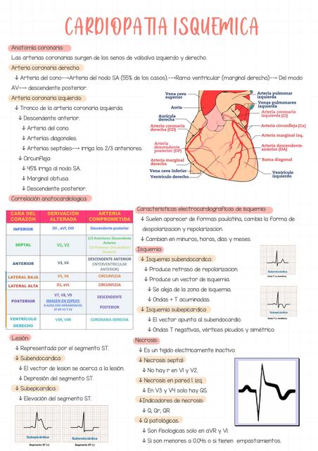 Cardiopatía Isquémica | Medicina.zip | uDocz