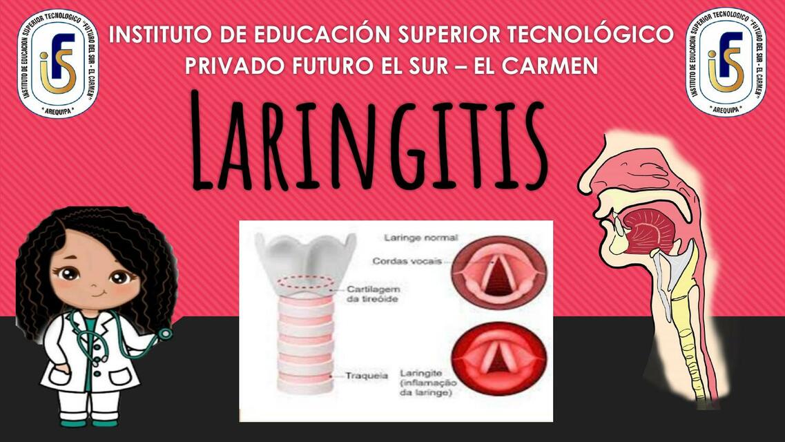 Resúmenes de Laringitis aguda | Descarga apuntes de Laringitis aguda