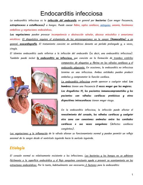 Endocarditis infecciosa | medi_fer | uDocz