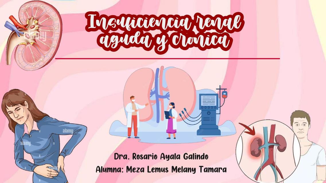 Insuficiencia renal aguda y crónica | mundo_d.enfermeria | uDocz