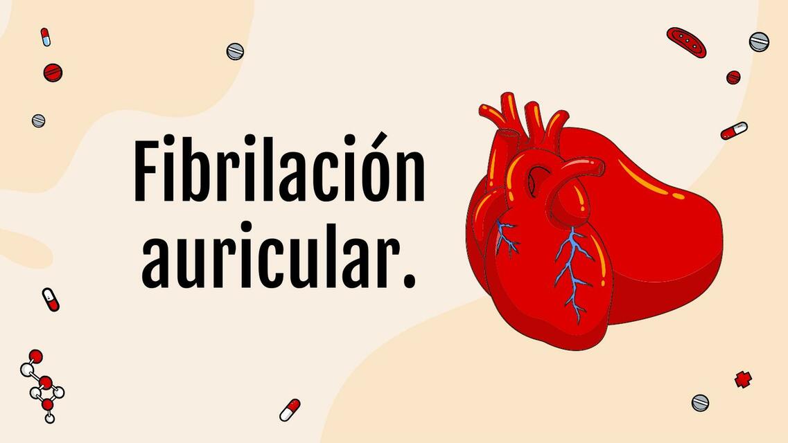 Fibrilación Auricular | Nathalia Reyes Diaz | uDocz